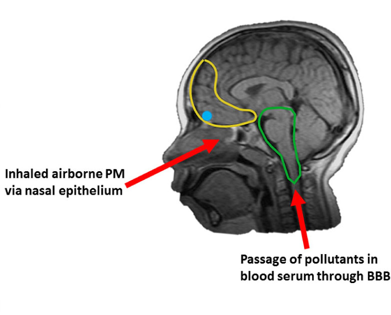 New Study Links PM Pollution to Depression and Suicide – Downwinders at ...